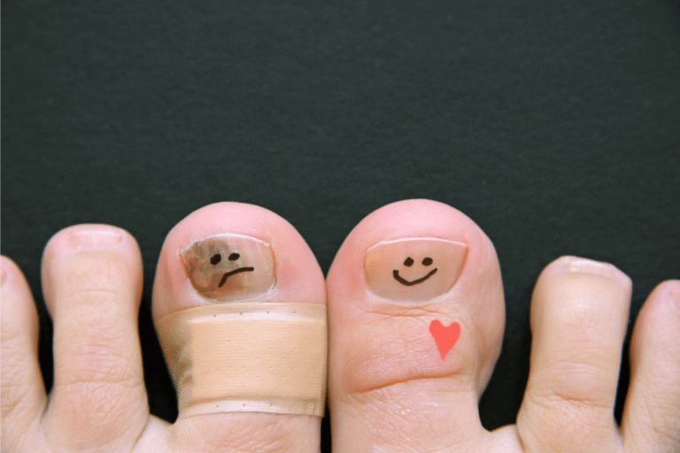 How Can Something So Small Hurt So Much? A Guide to "Tip of the Toe ...