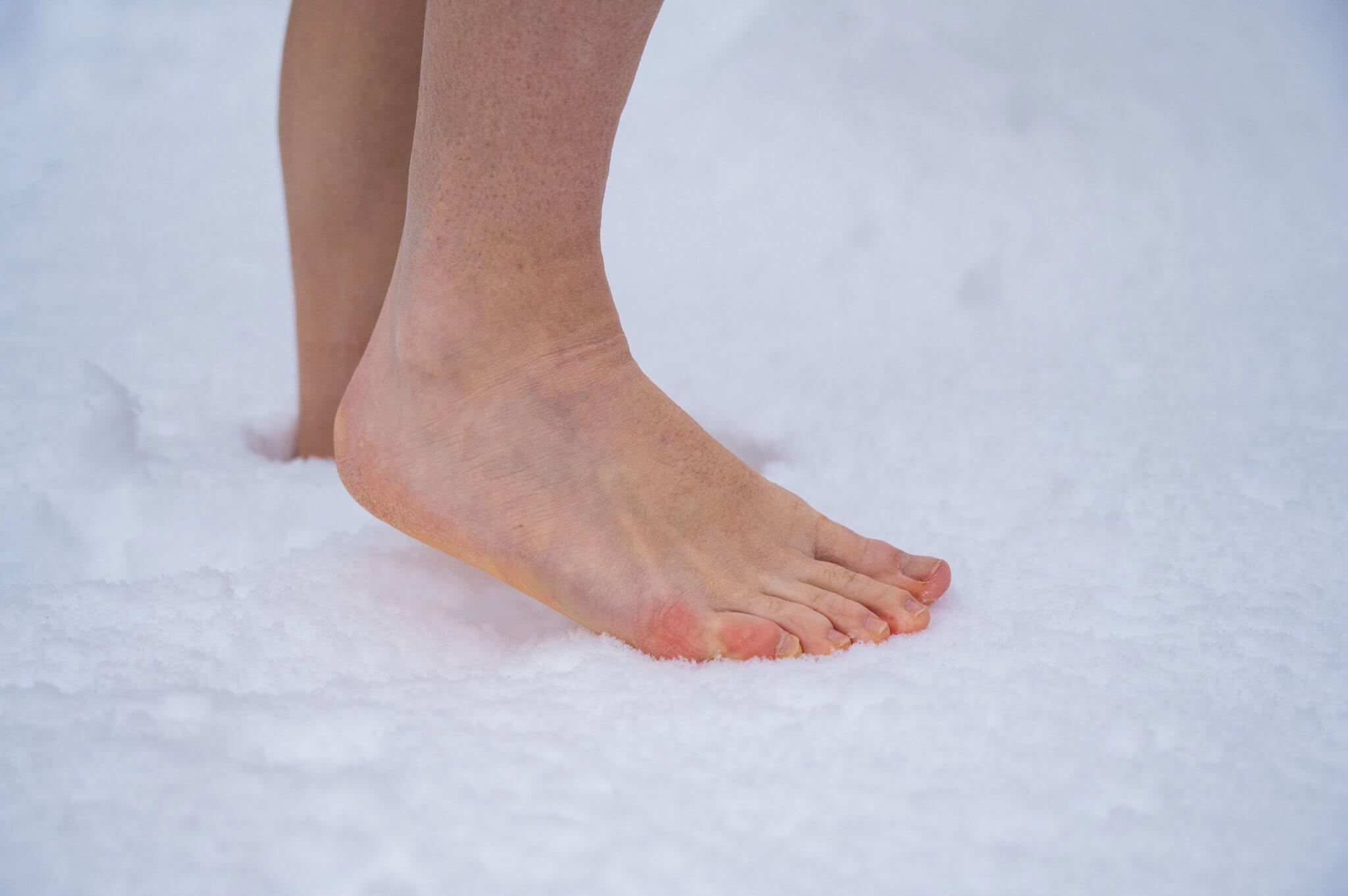 Do You Have Frostbite? - Advanced Foot Care of NJ, LLC